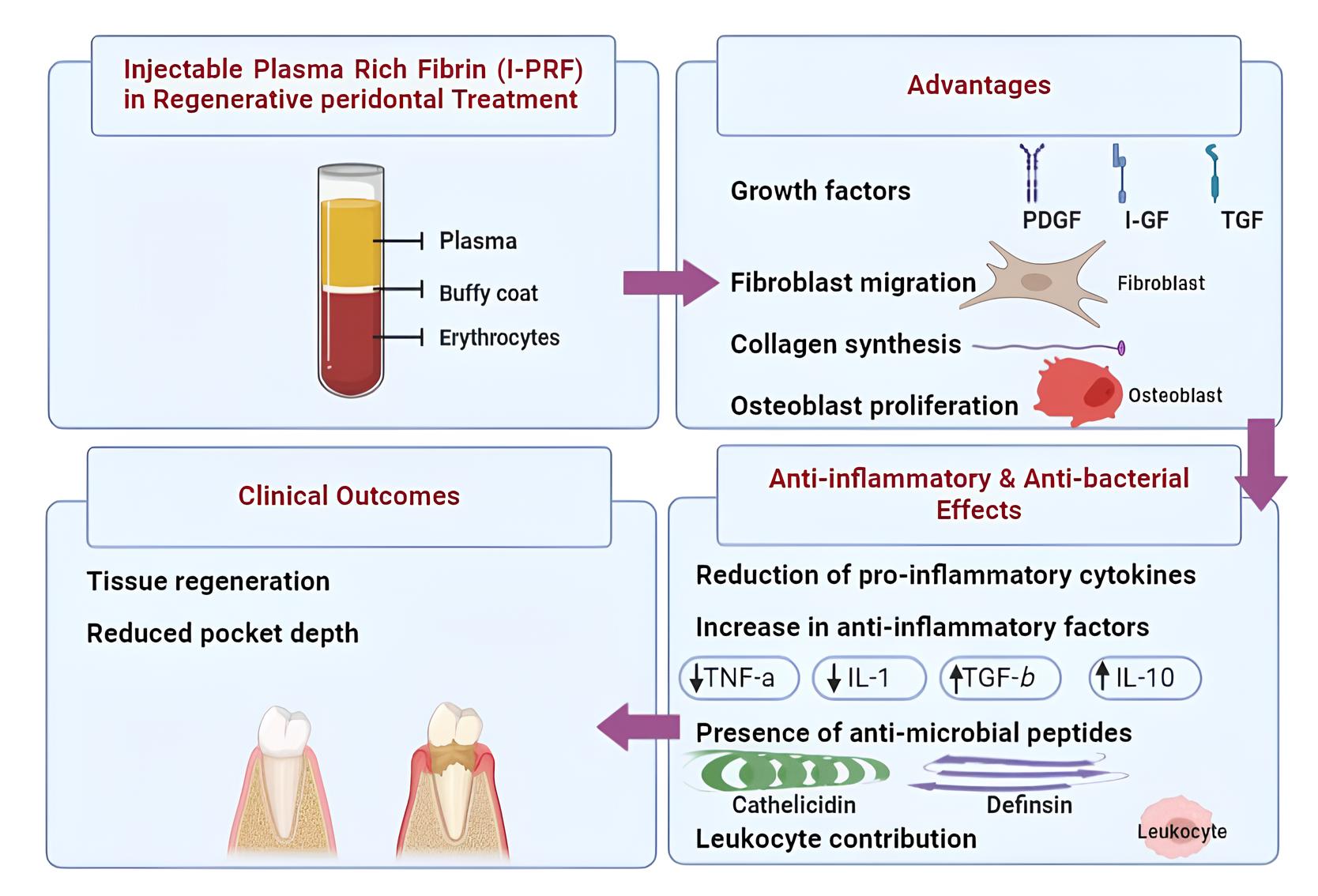 Opportunity of injectable plasma-rich fibrin in regenerative ...